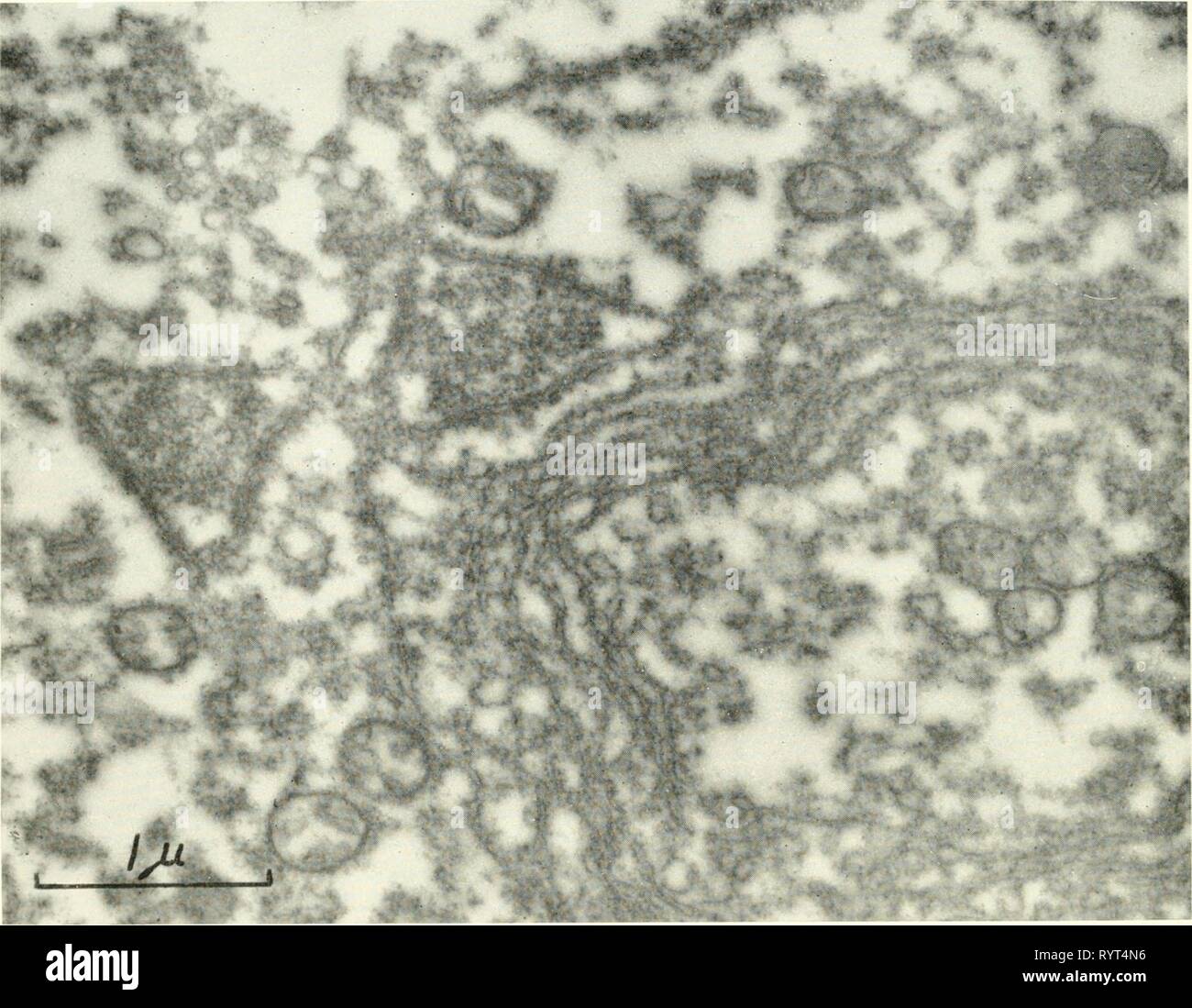 Electron microscopy; proceedings of the Electron microscopy ...