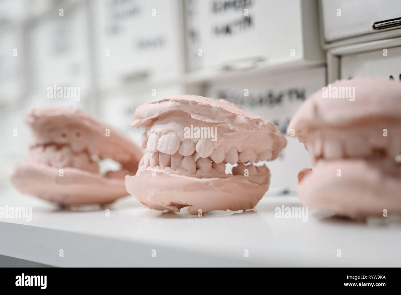Cast teeth models hi-res stock photography and images - Alamy