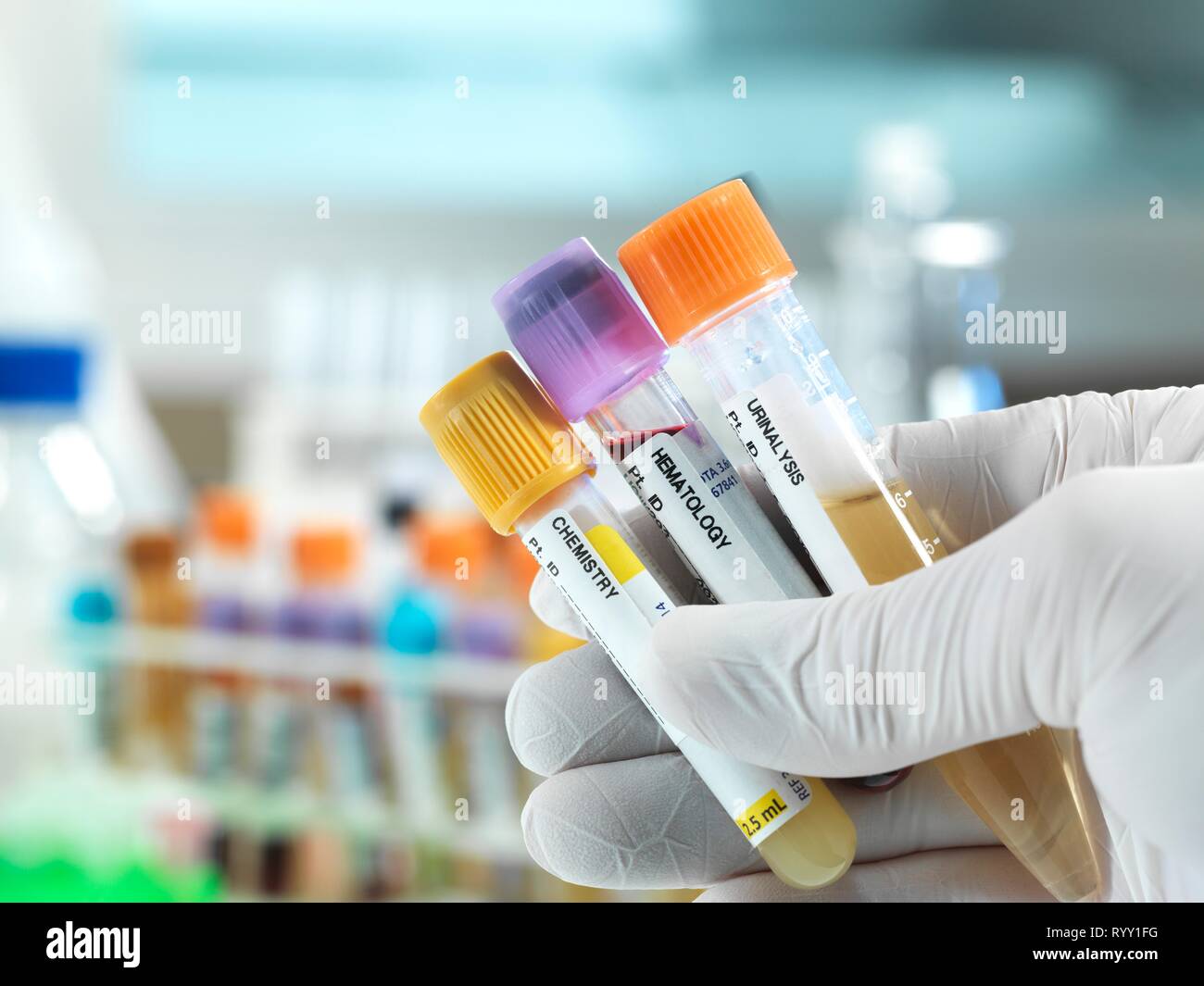 Technician holding Blood, urine and chemistry human samples for ...