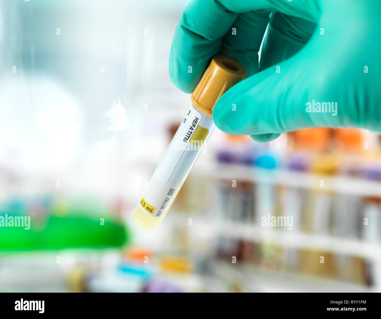 Tests in hospital pathology laboratory hi-res stock photography and ...