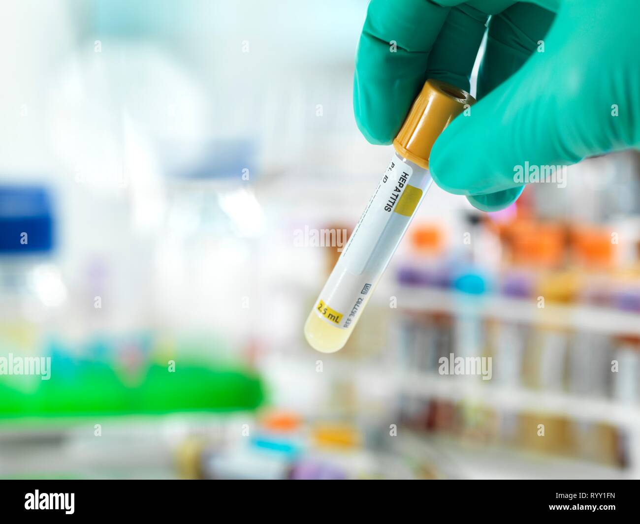 Blood samples in blood collection hi-res stock photography and images ...