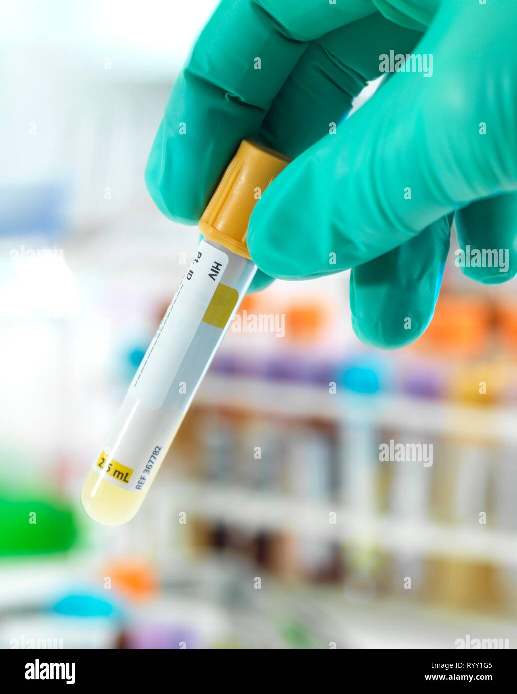 Doctor preparing a HIV test sample for testing in the laboratory Stock ...