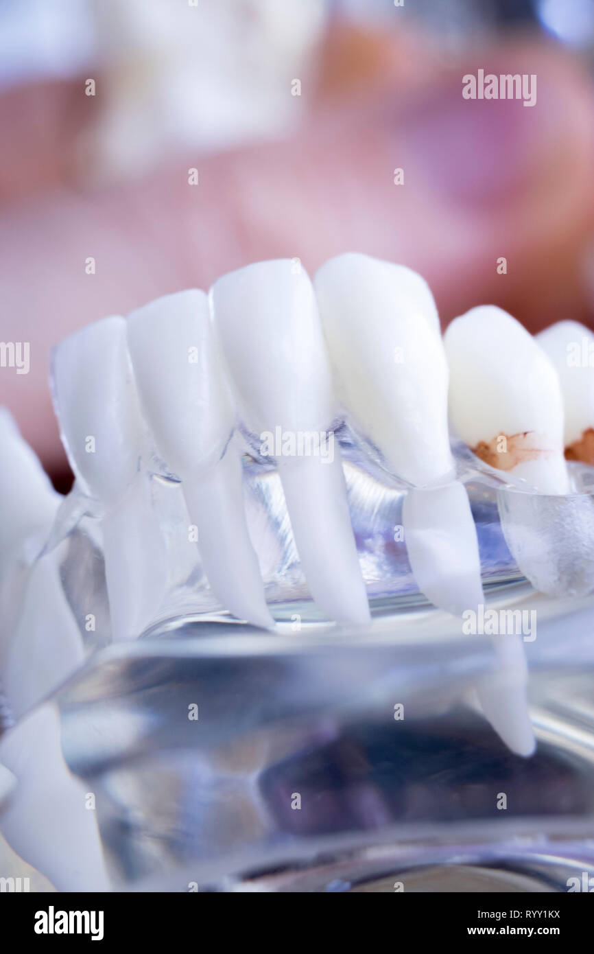 Dentist dental teeth teaching model showing each tooth and gum for ...