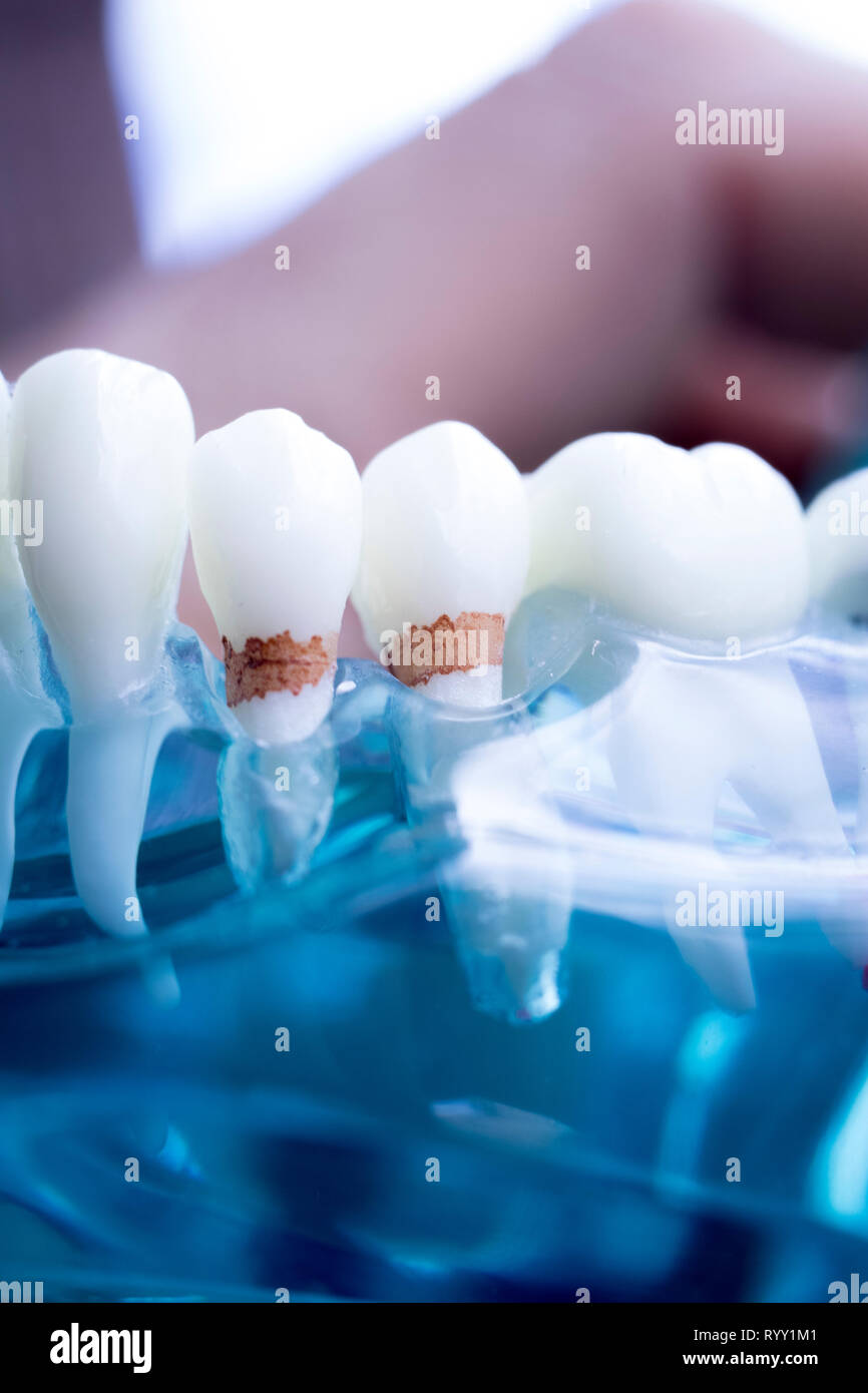 Dentist dental teeth teaching model showing each tooth and gum for ...