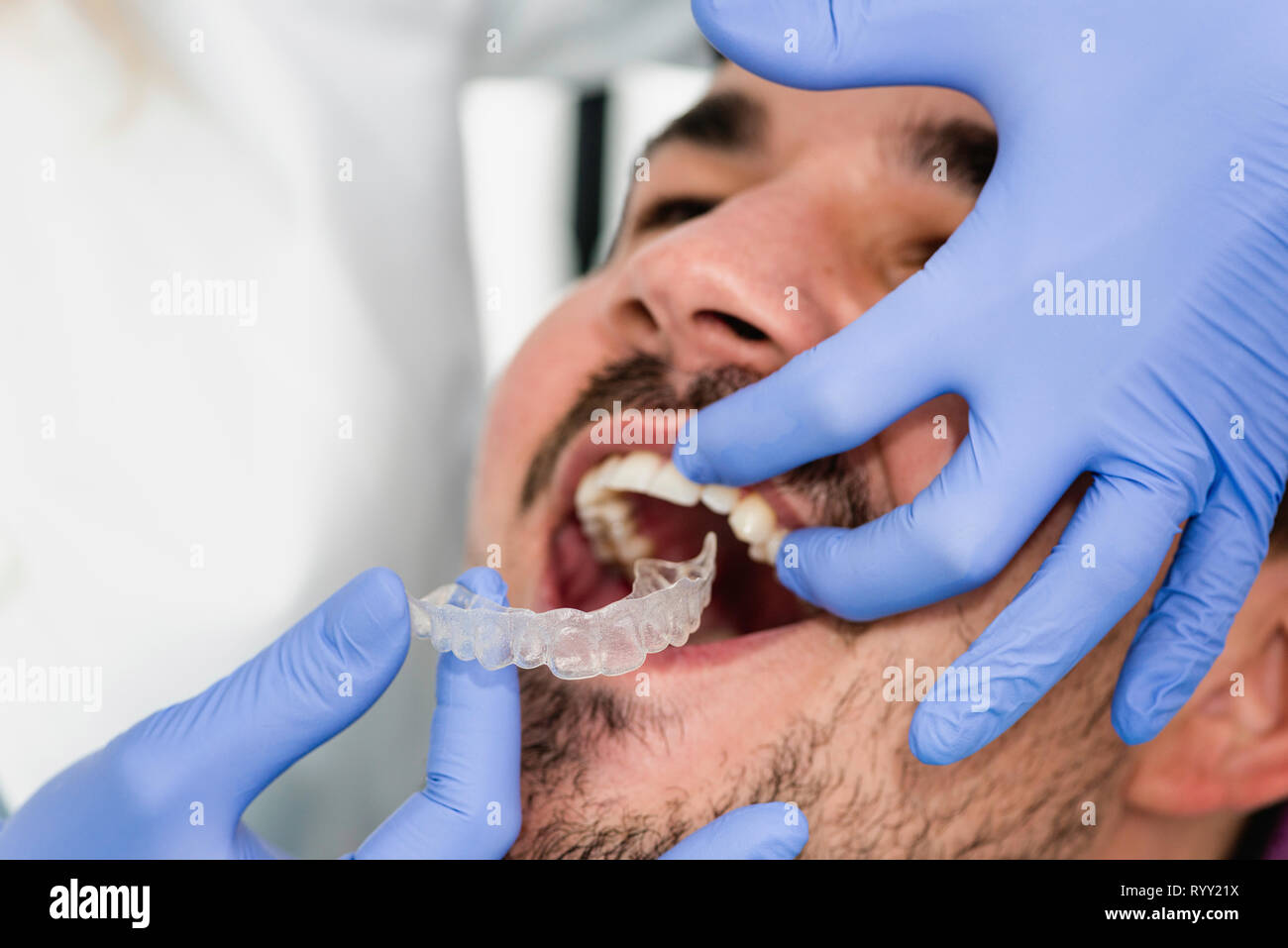 Invisible braces hi-res stock photography and images - Alamy