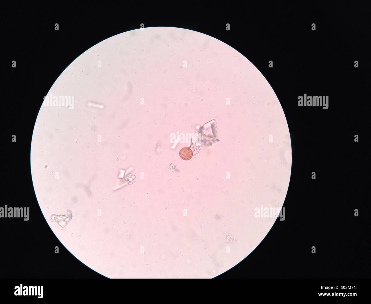 Egg Parasite Stock Photos & Egg Parasite Stock Images - Alamy