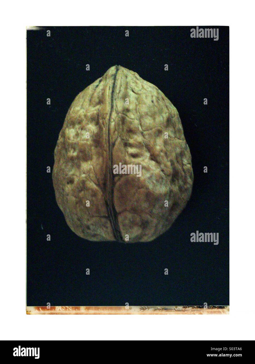 Nut allergy hi-res stock photography and images - Alamy