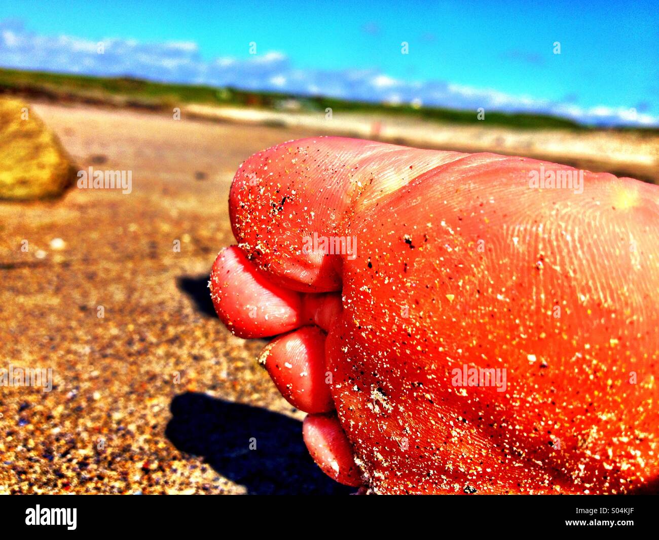 Sunburn feet hi-res stock photography and images - Alamy