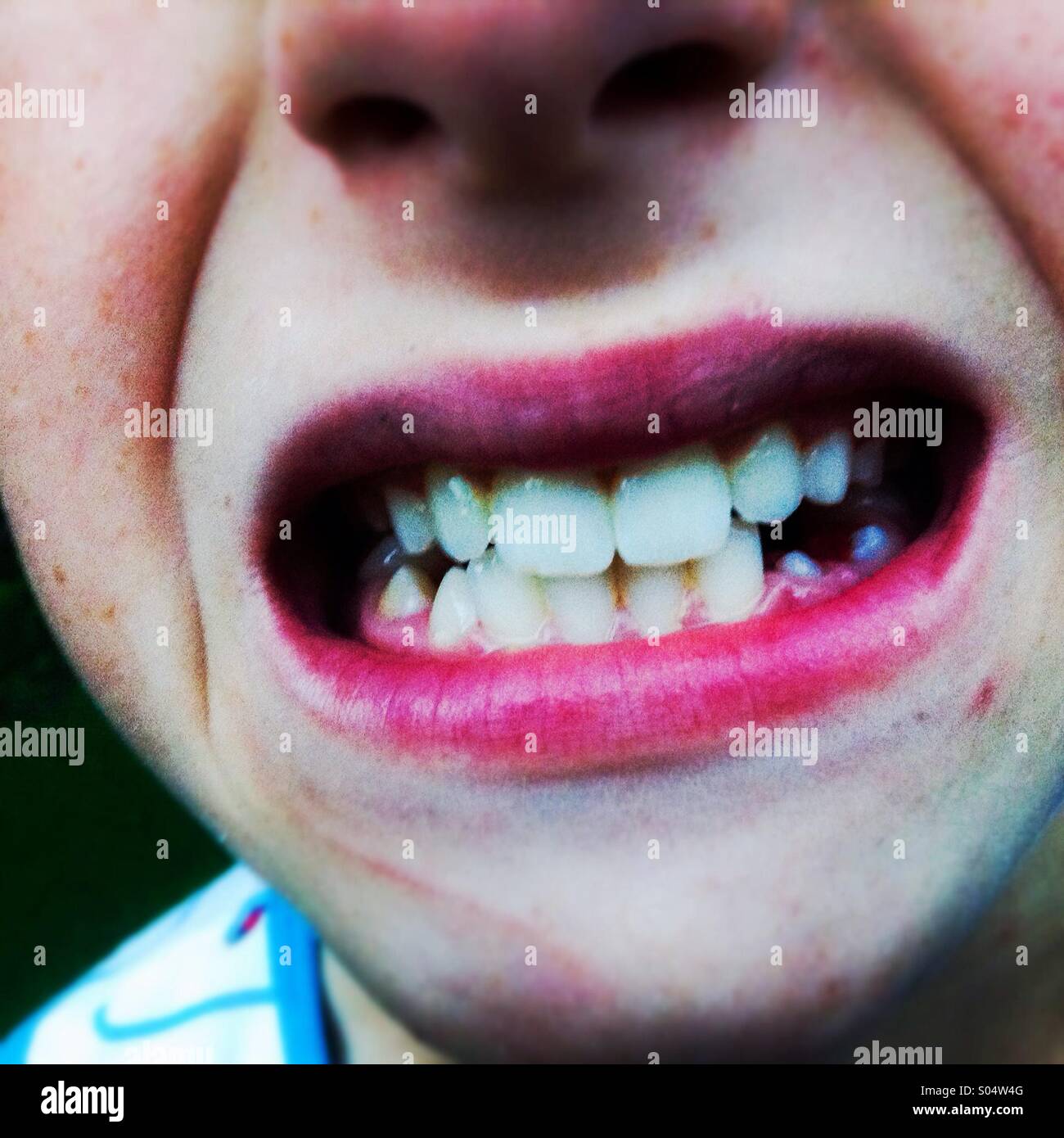 Boy crying and showing his teeth Stock Photo - Alamy