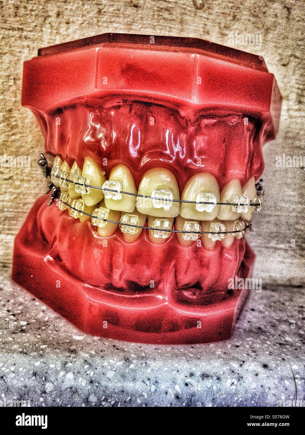 Dentist mould hi-res stock photography and images - Alamy