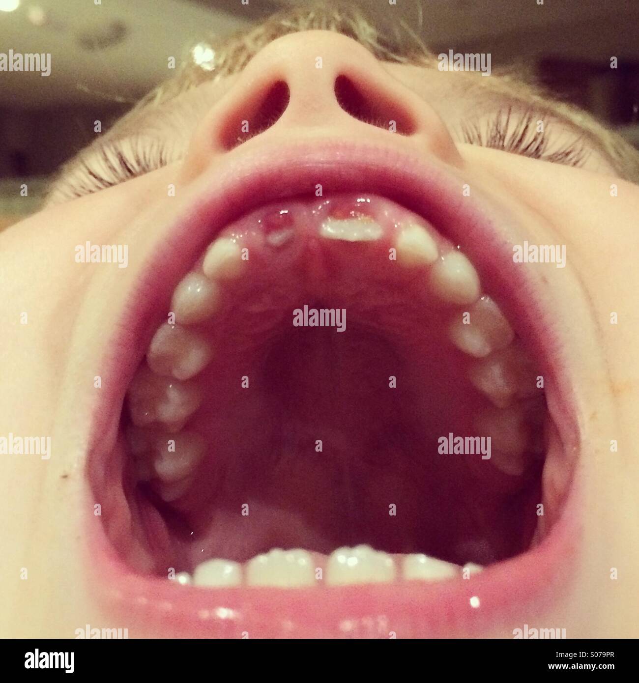 Boy with missing front teeth hi-res stock photography and images - Alamy