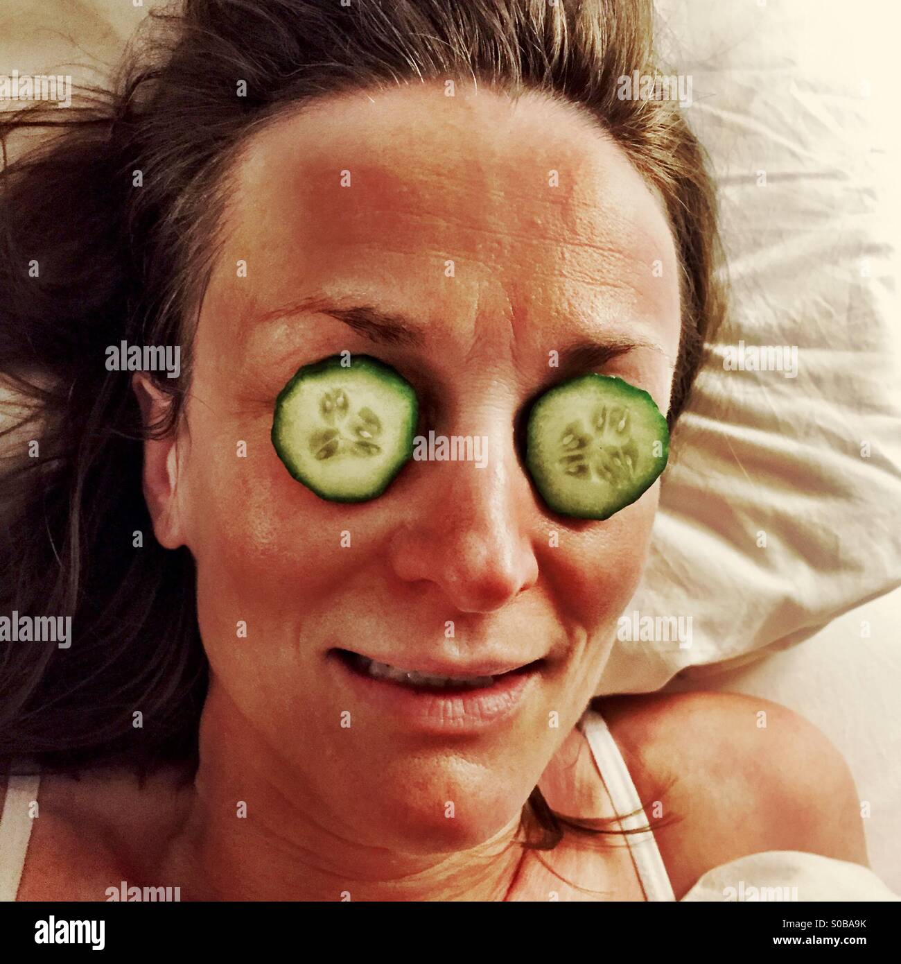 Sliced Cucumbers On Eyes