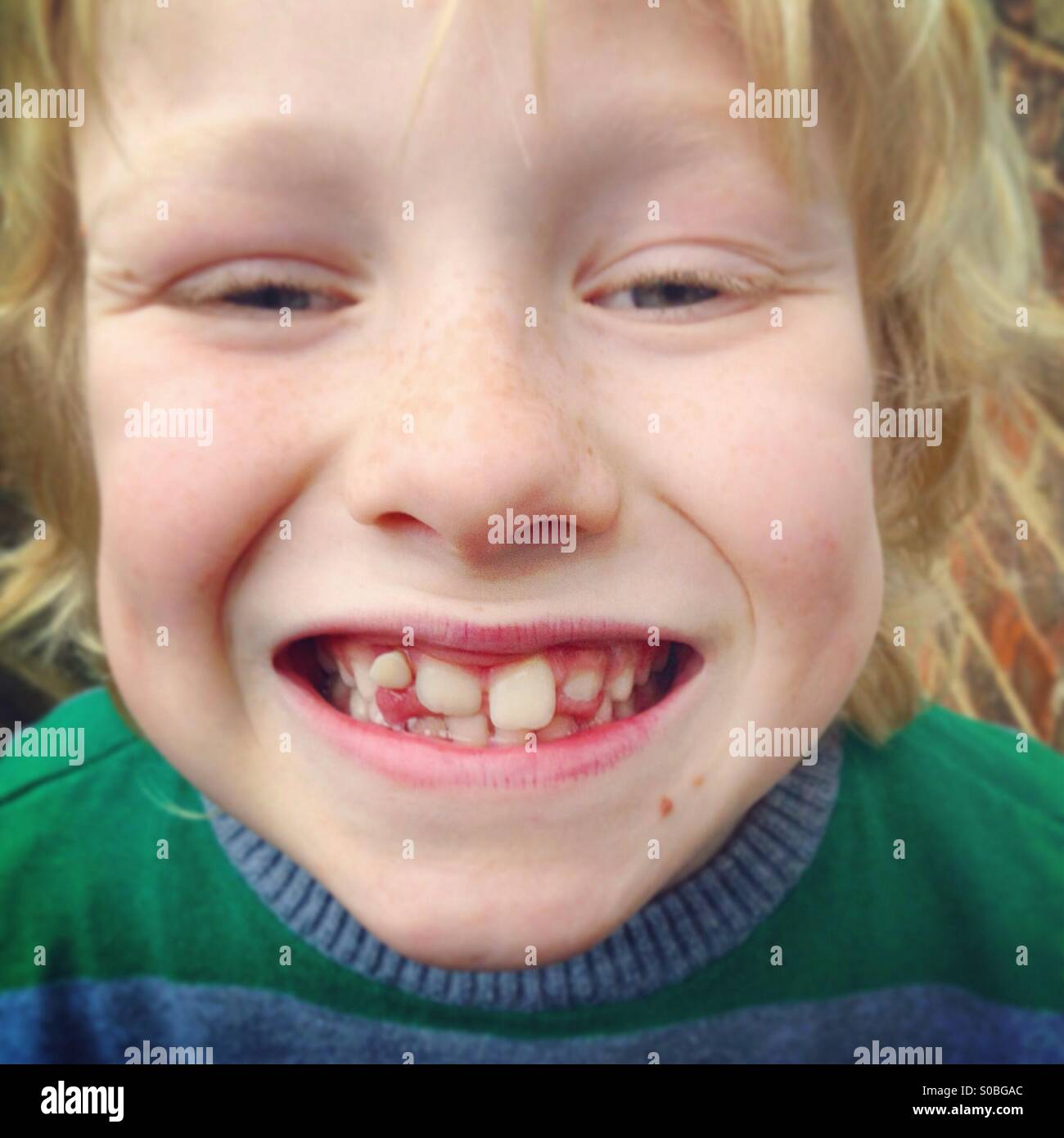 Wobble tooth hi-res stock photography and images - Alamy