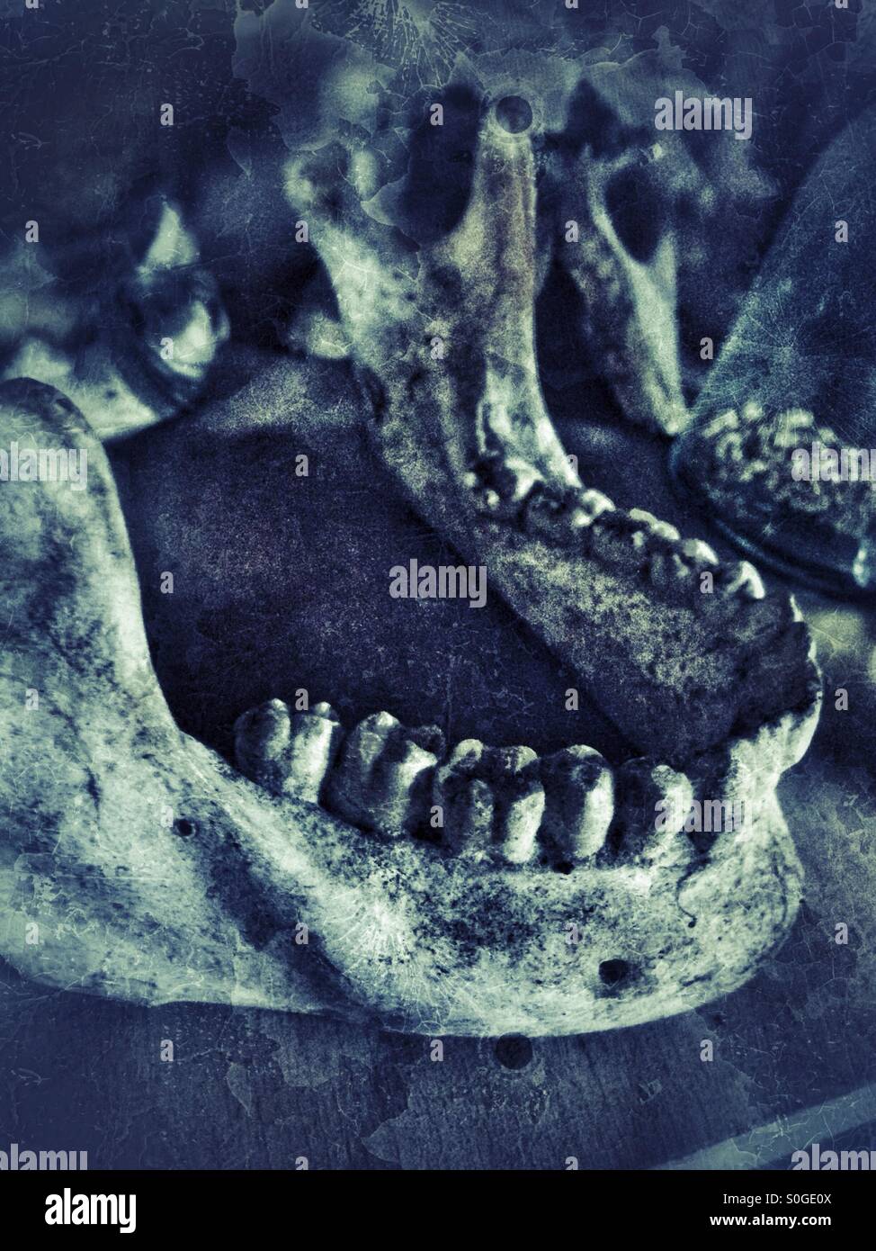 Human jaw hi-res stock photography and images - Alamy