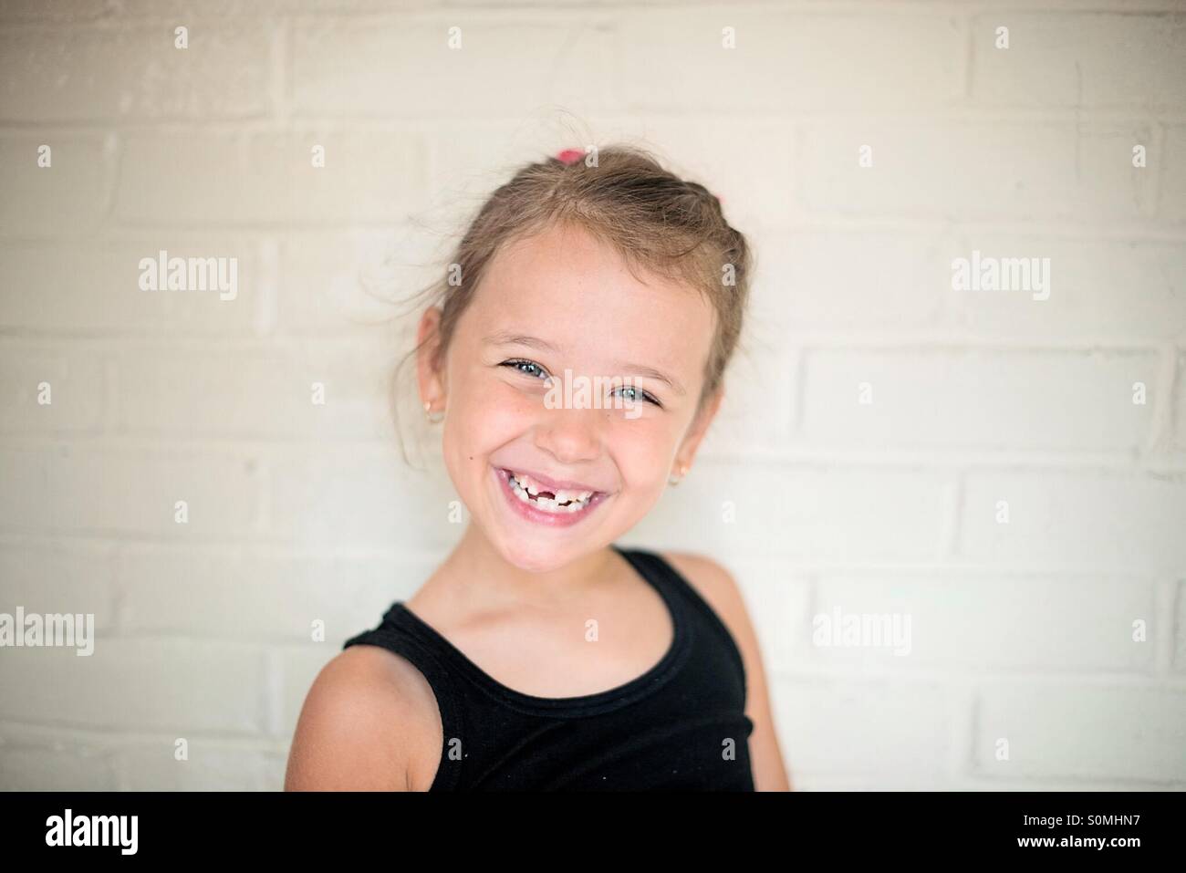 Lost teeth hi-res stock photography and images - Alamy