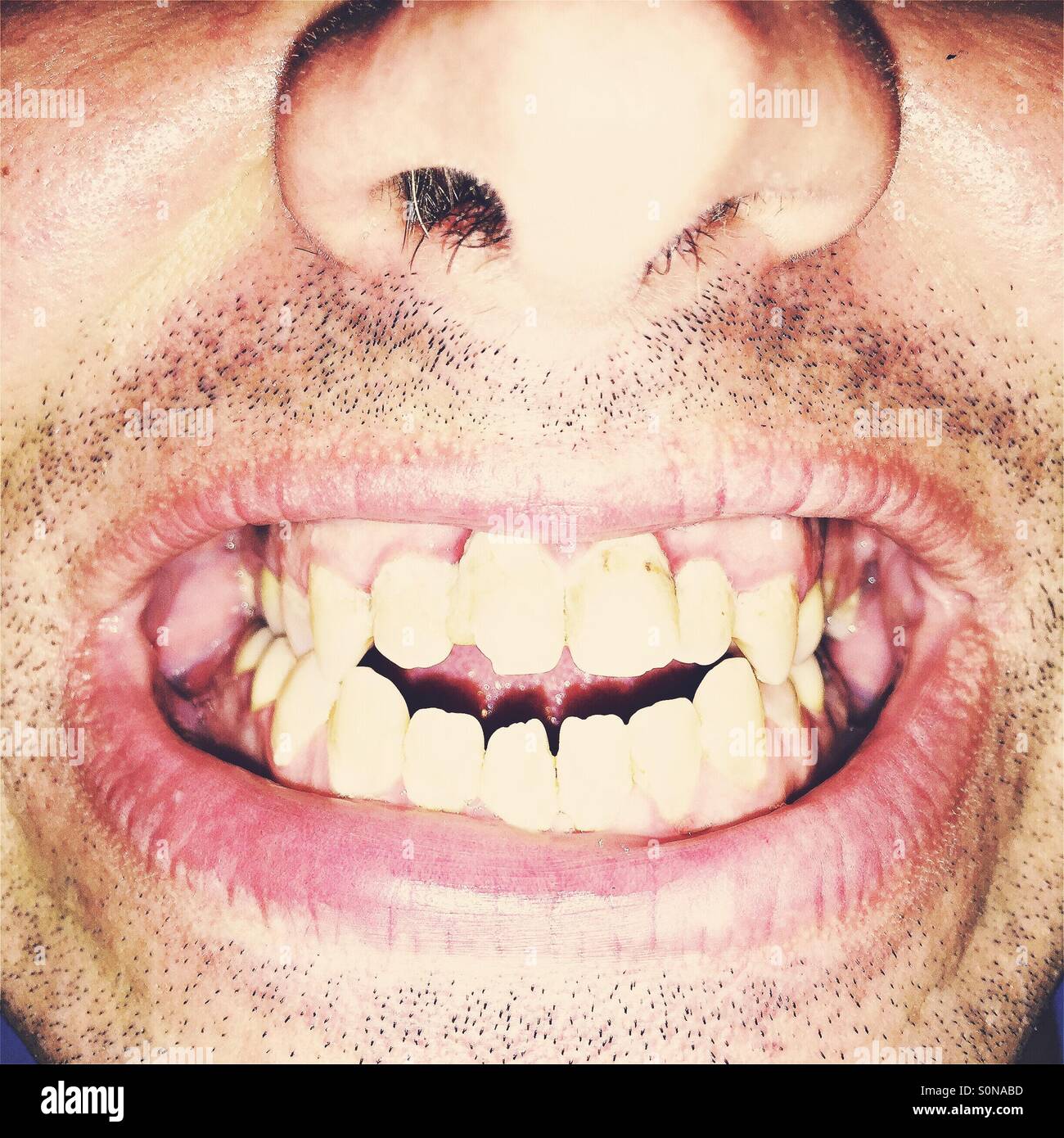 Adult man crooked teeth hi-res stock photography and images - Alamy