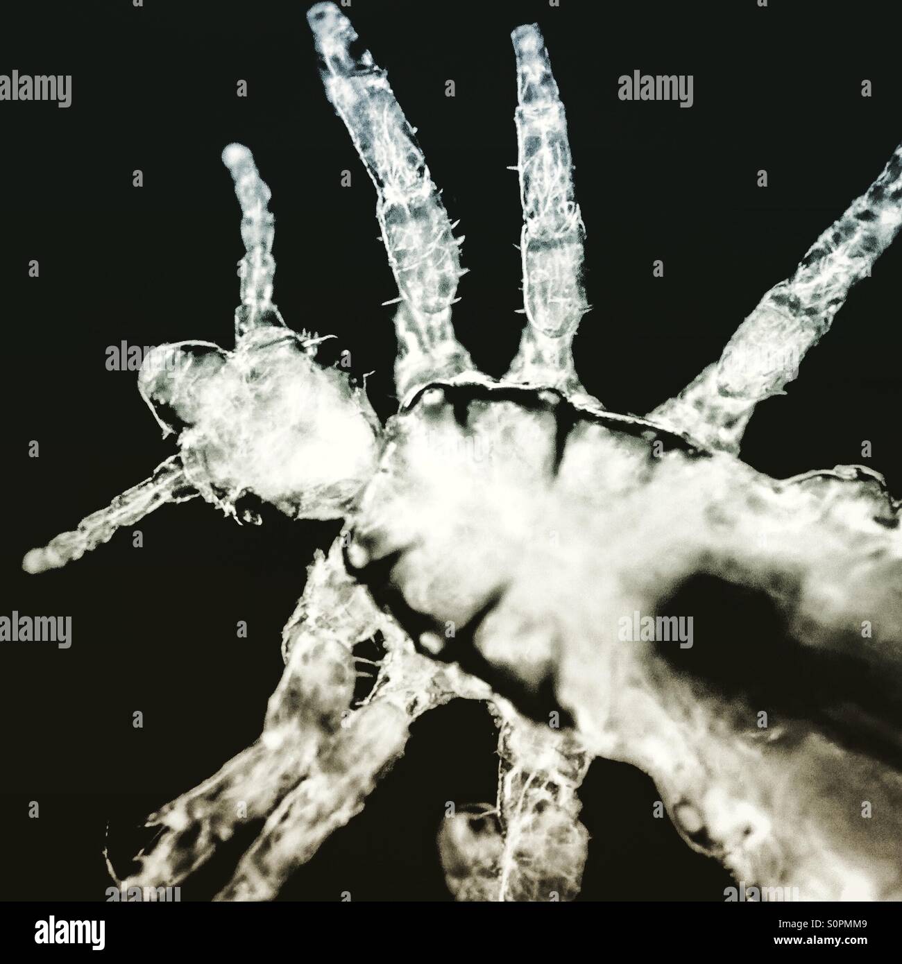 Head lice hi-res stock photography and images - Alamy