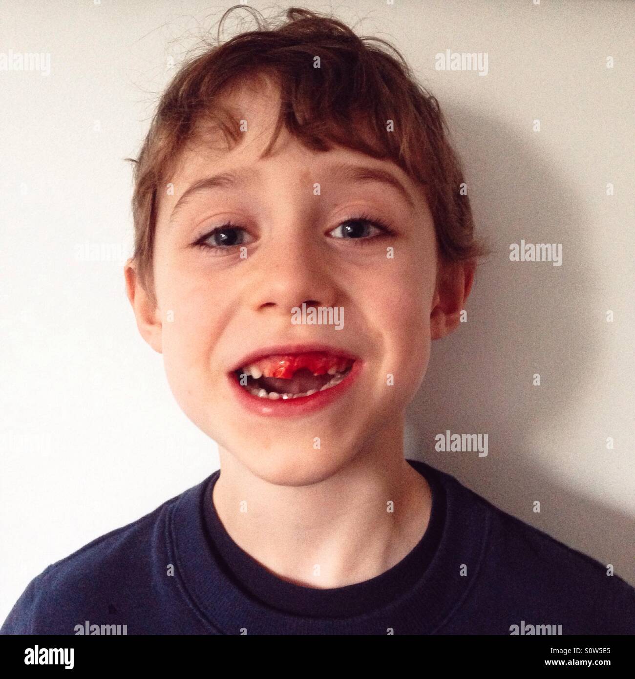 Bloody Teeth High Resolution Stock Photography and Images - Alamy