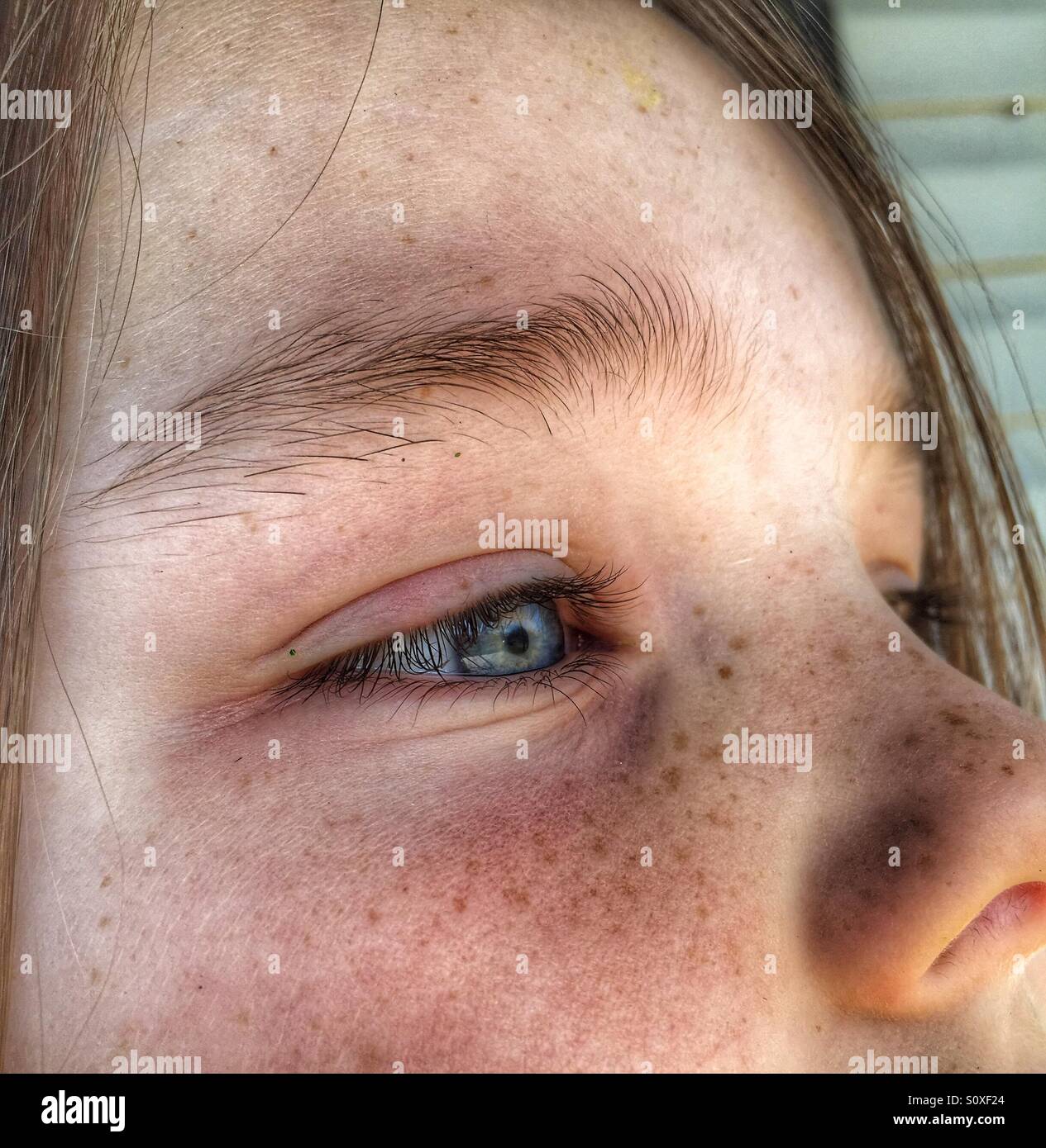 Girl freckles hi-res stock photography and images - Alamy