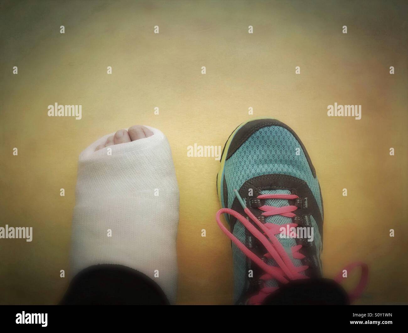 Foot Cast High Resolution Stock Photography and Images - Alamy