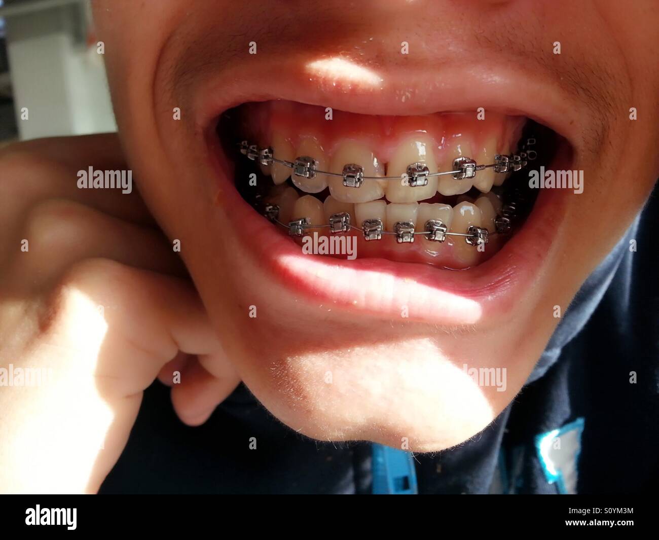 The surfaces band hi-res stock photography and images - Alamy