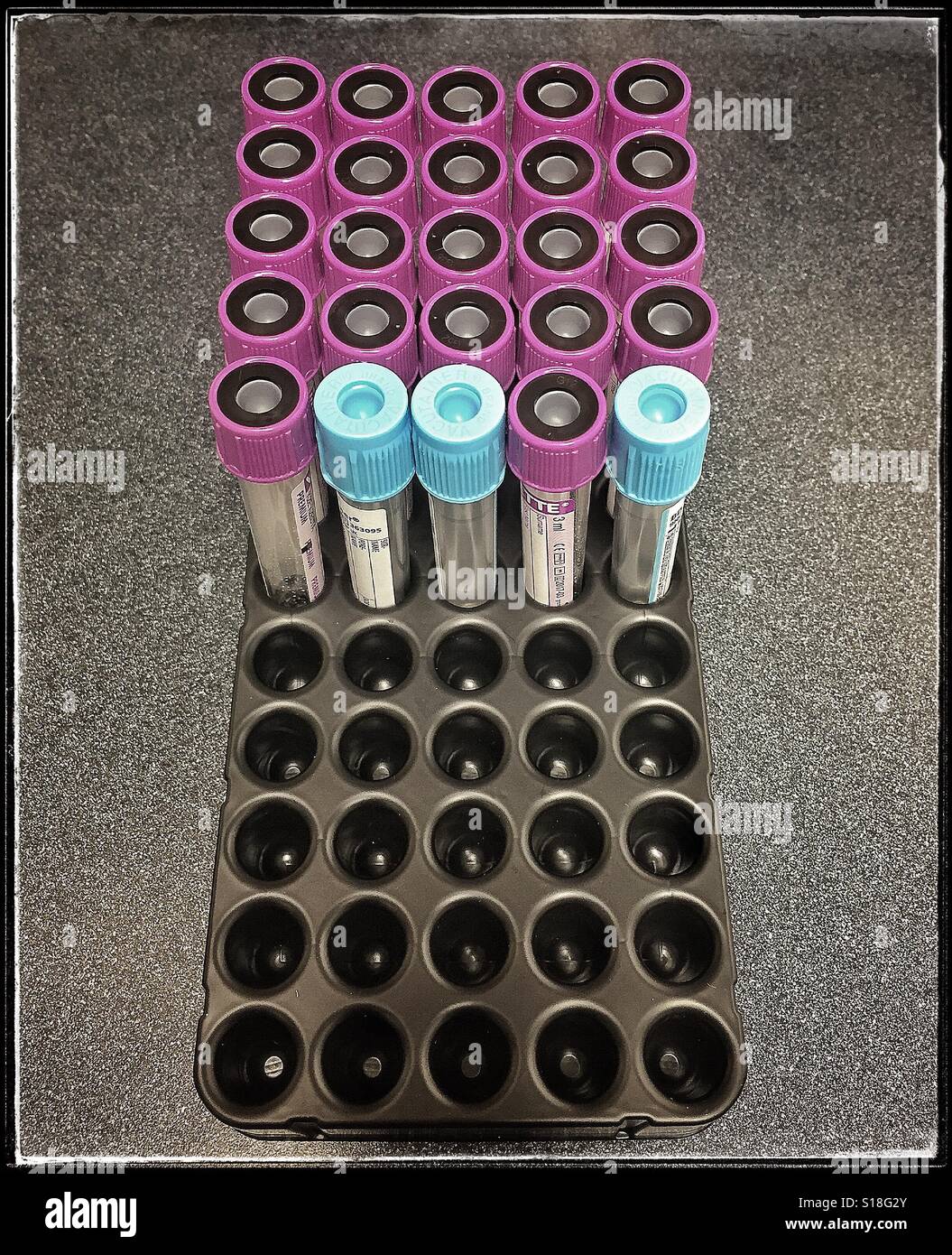 Blood bottles hi-res stock photography and images - Alamy