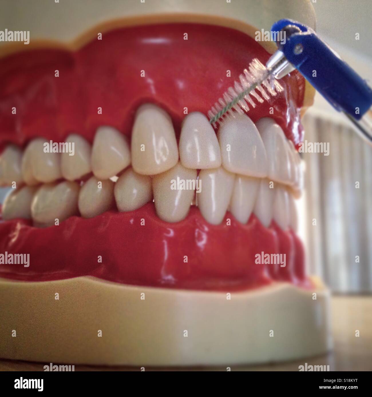 Teeth in gums hi-res stock photography and images - Alamy