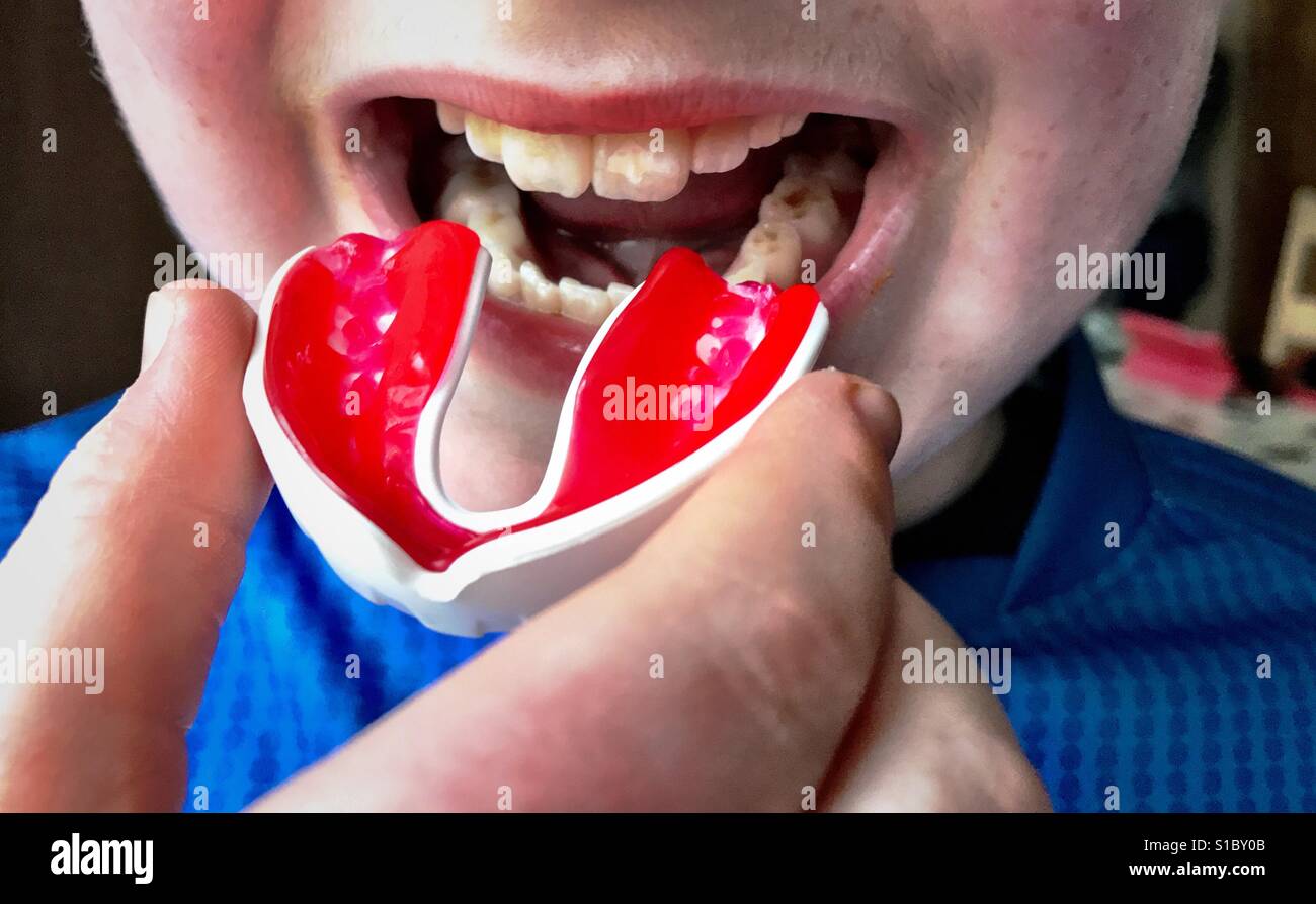 Mouth guard protection hi-res stock photography and images - Alamy