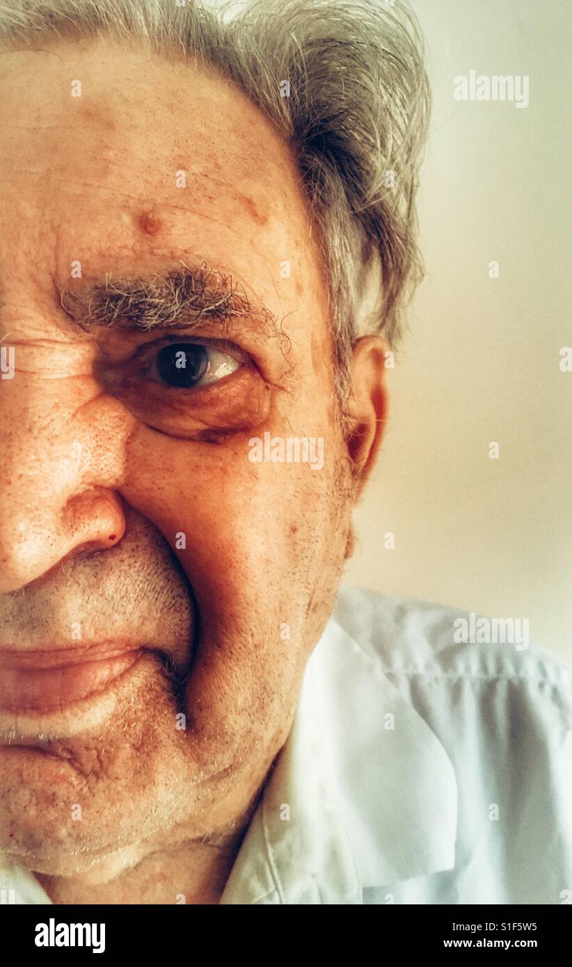 87-year old man with type 2 diabetes Stock Photo - Alamy