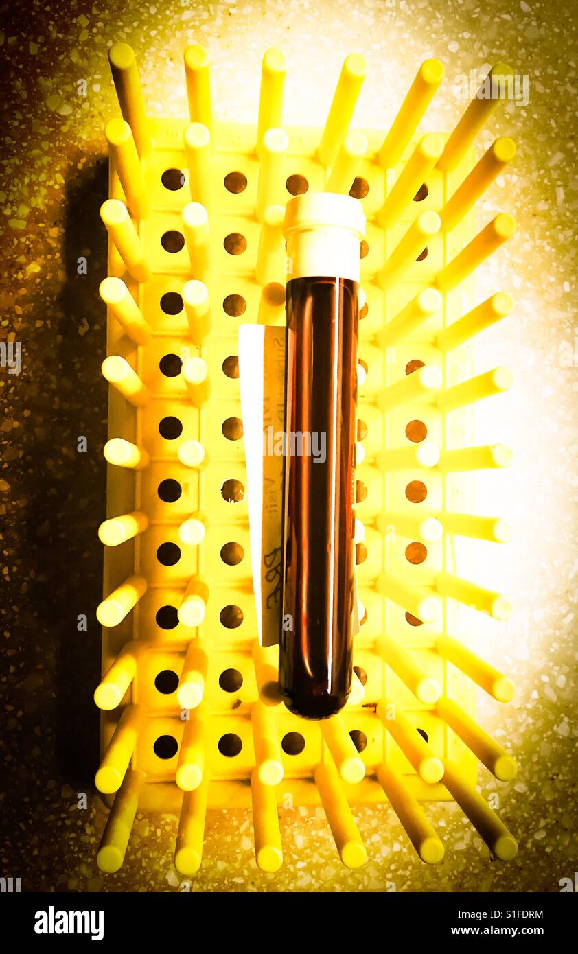 Blood vial hi-res stock photography and images - Alamy