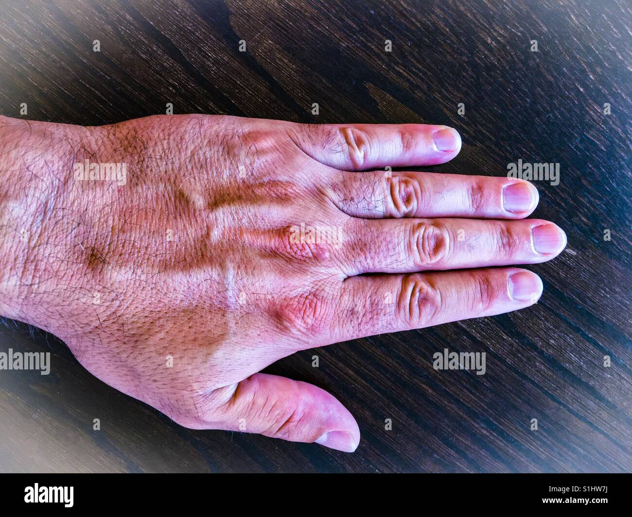 Red hand hi-res stock photography and images - Alamy