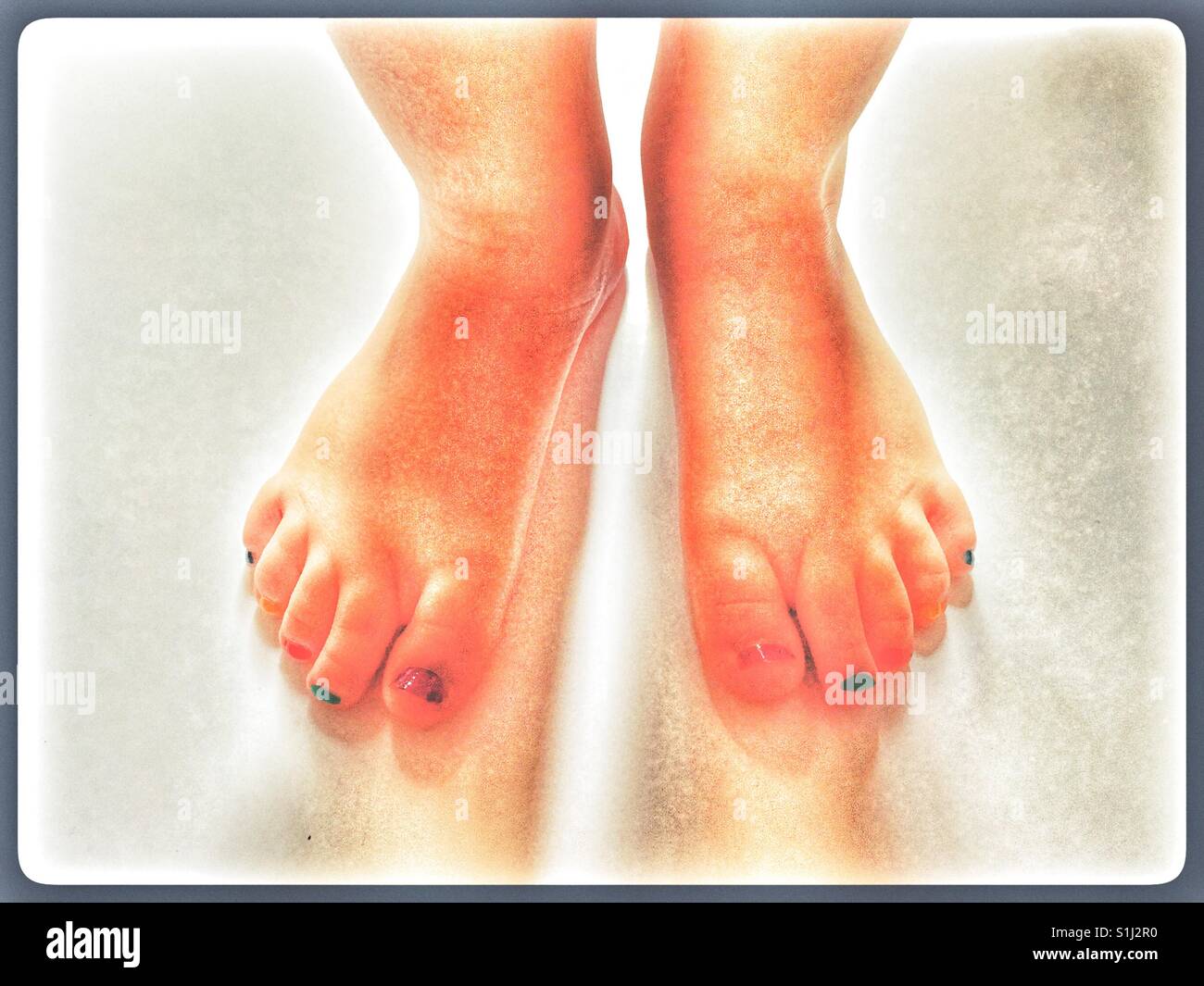 Toe nails hi-res stock photography and images - Alamy