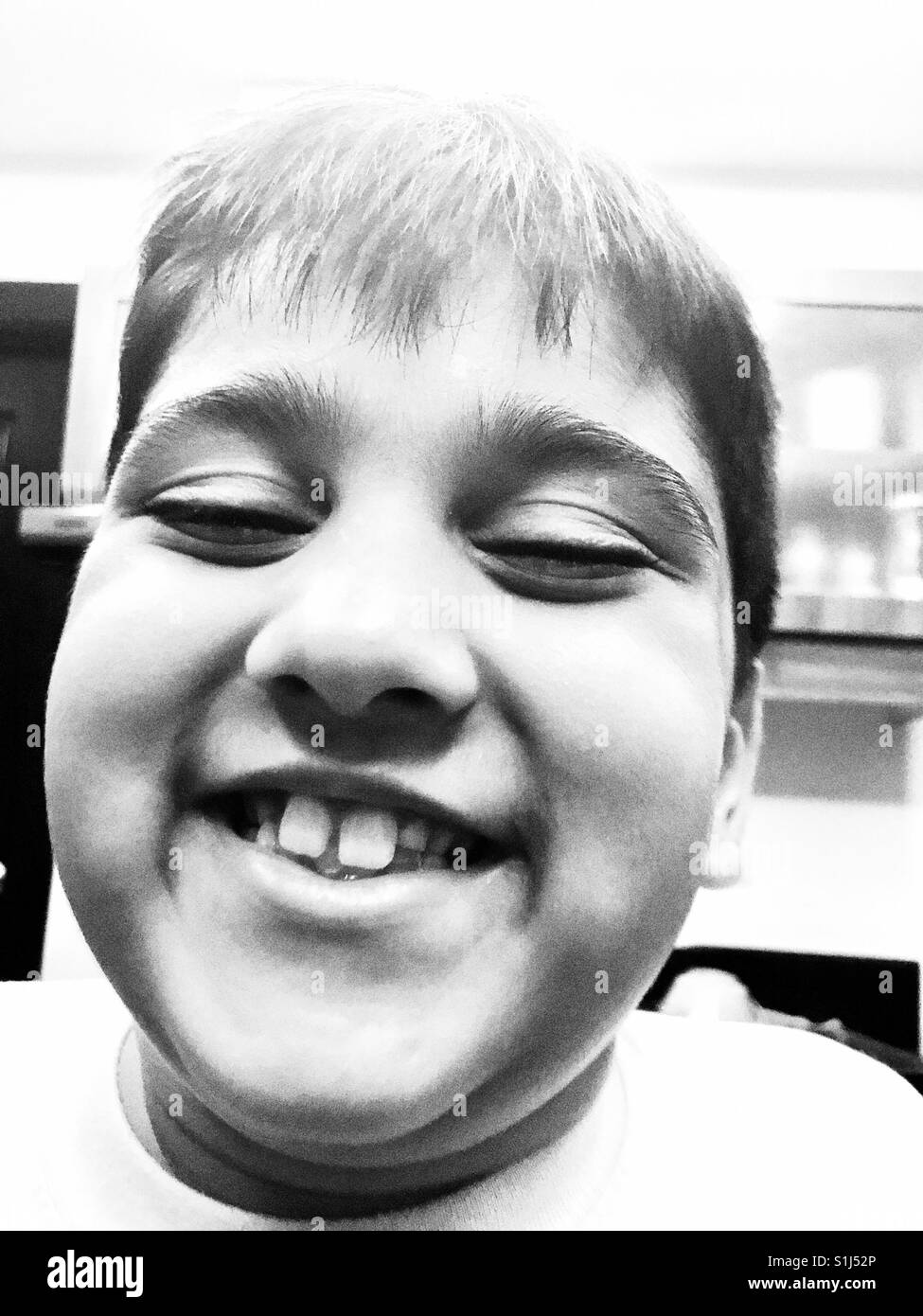 Permanent teeth hi-res stock photography and images - Alamy