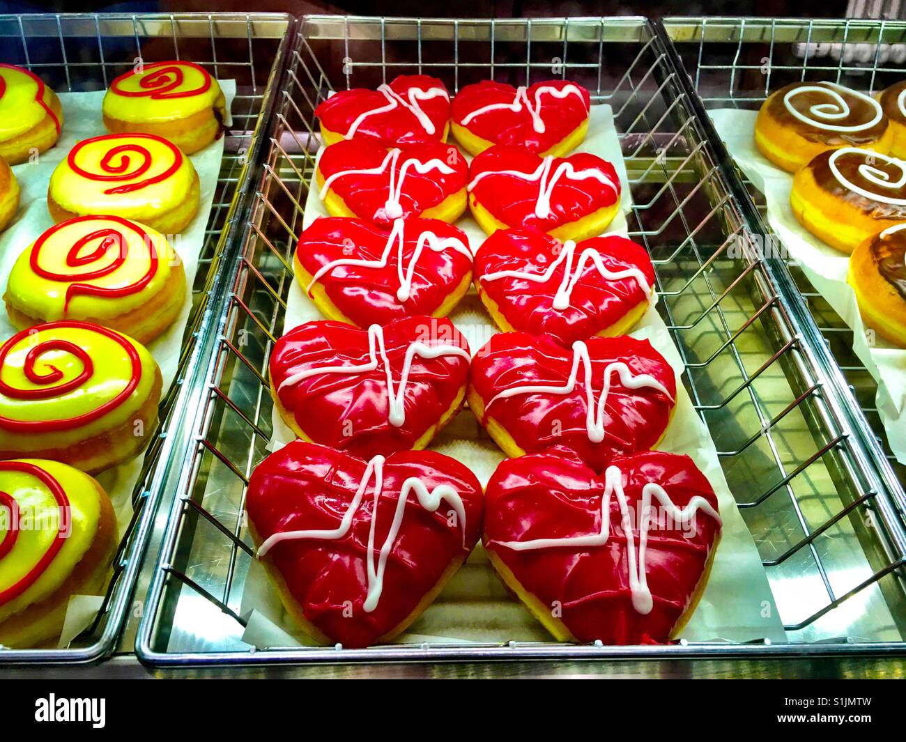 Ekg heart attack hi-res stock photography and images - Alamy