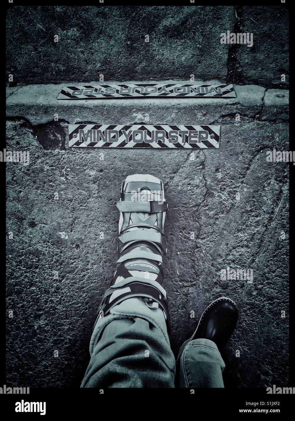 "Mind your step"sign on pavement and pedestrian with foot in moon boot ...