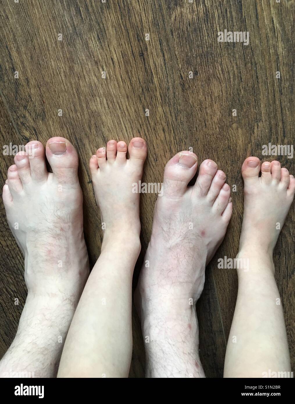 4 toes hi-res stock photography and images - Alamy