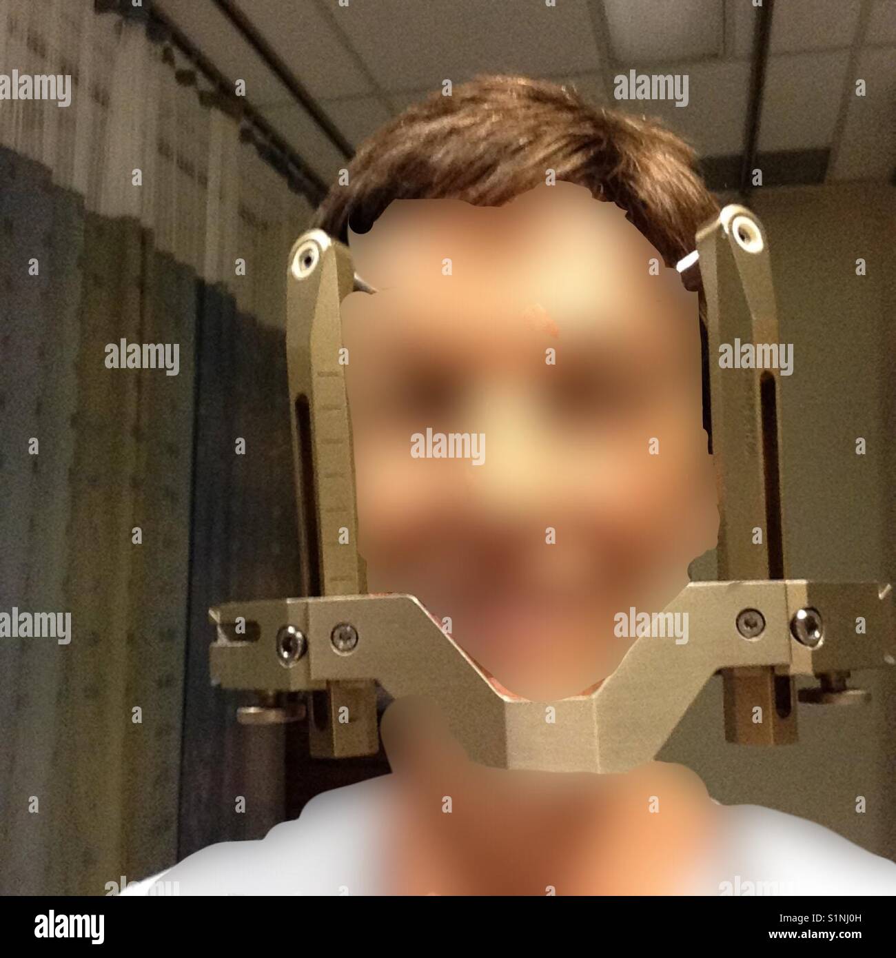 Markers for brain radiation Stock Photo - Alamy