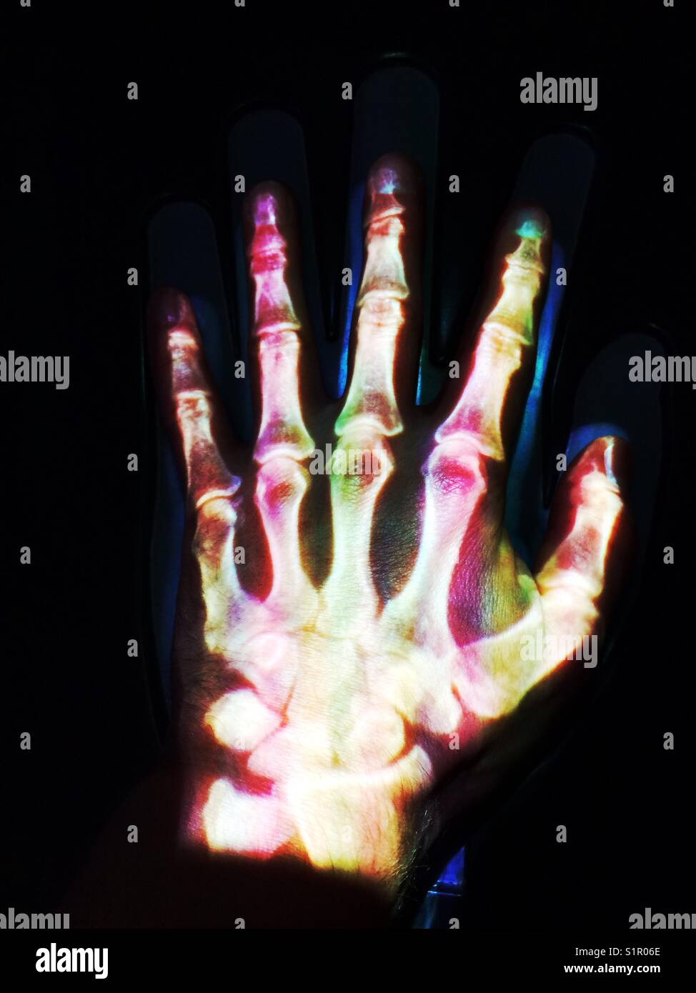 Bones and joints hi-res stock photography and images - Alamy