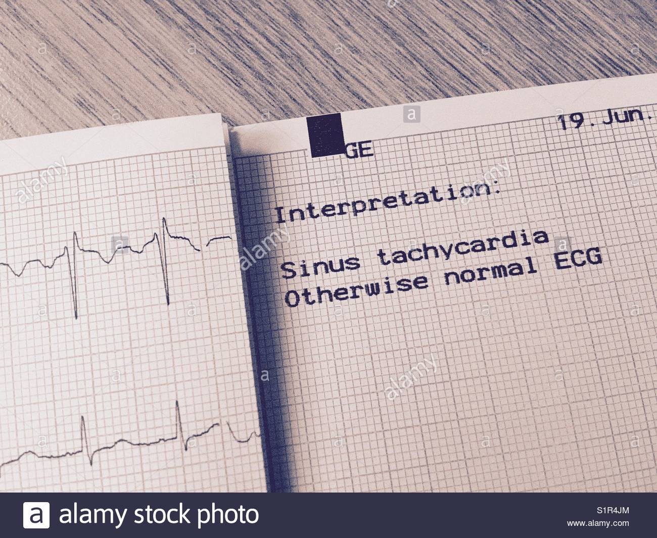 Ecg Test Stock Photos & Ecg Test Stock Images - Alamy