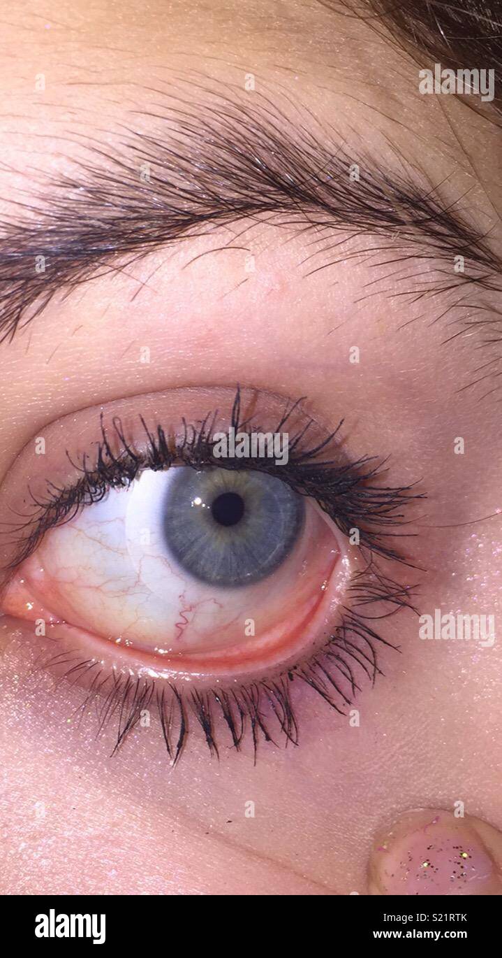 An eye sore hi-res stock photography and images - Alamy