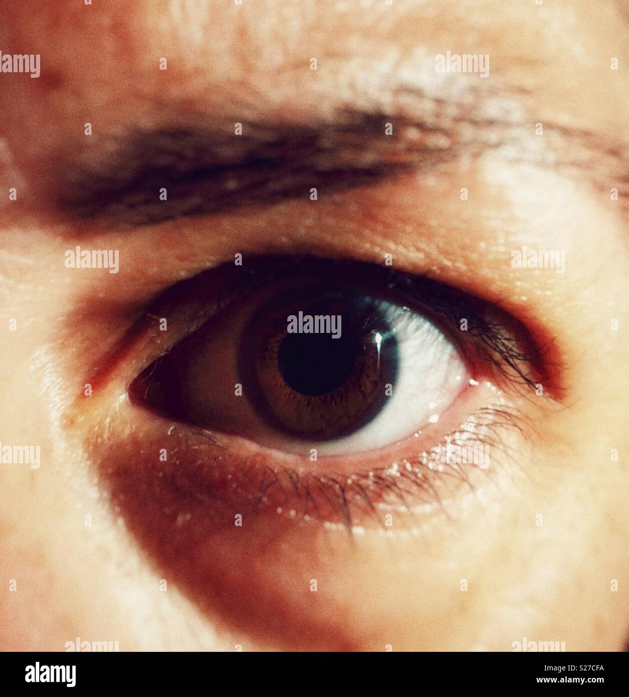 For dark eye circles hi-res stock photography and images - Alamy