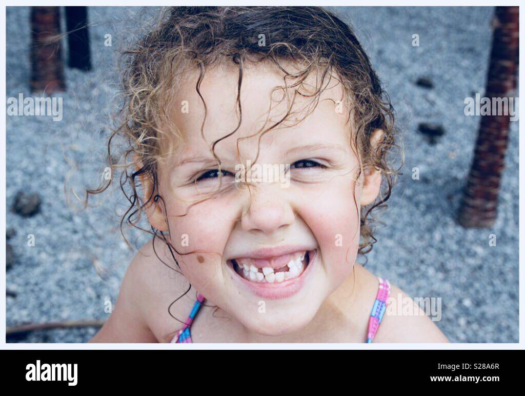 Close up of young girl with missing teeth Stock Photo - Alamy