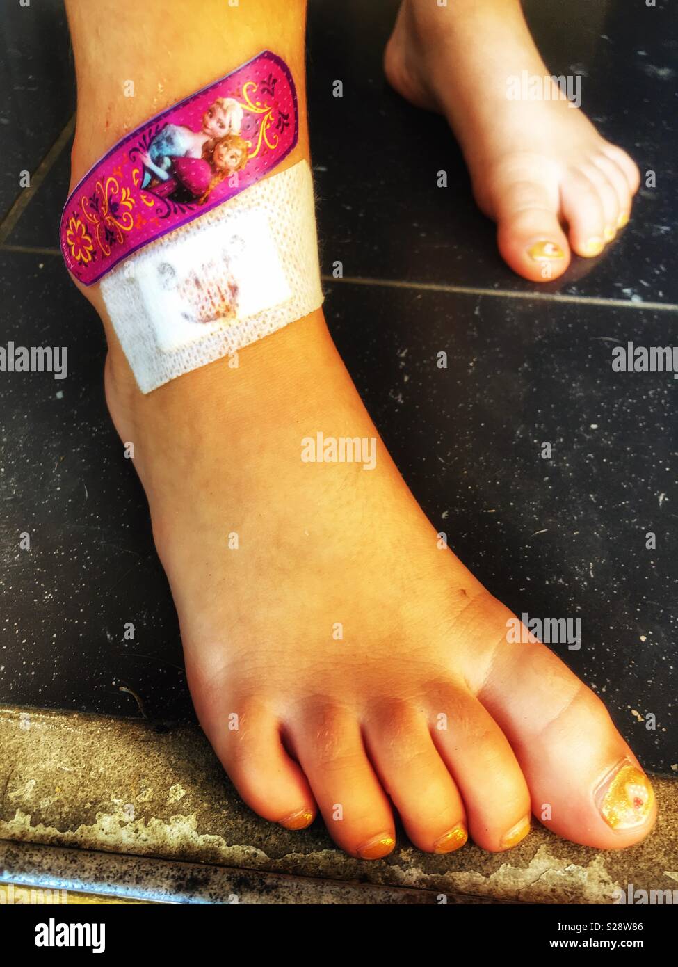 Walt Disney Frozen sticky plaster on a child’s ankle Stock Photo - Alamy