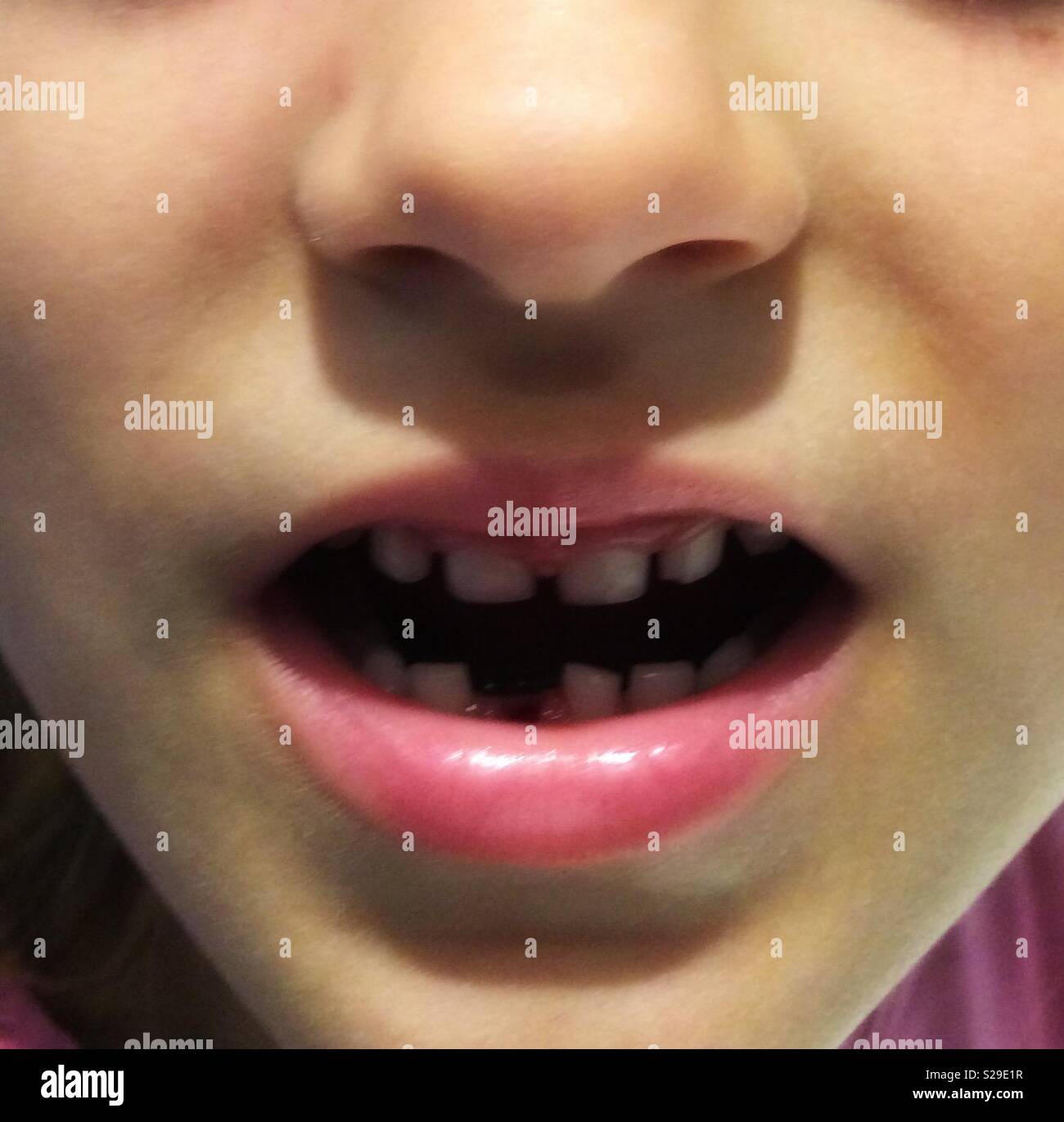 Children tooth hi-res stock photography and images - Alamy