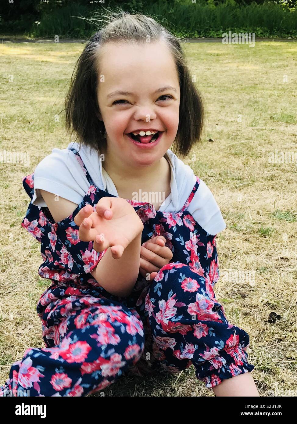 Beautiful girl with Down Syndrome Stock Photo - Alamy Beautiful girl with Down Syndrome Stock Photo - Alamy