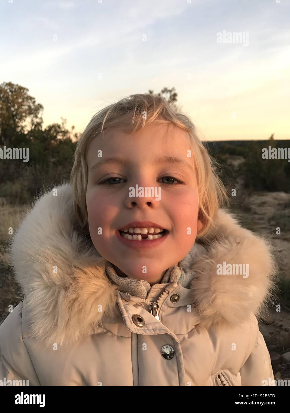 Lost Tooth High Resolution Stock Photography and Images - Alamy