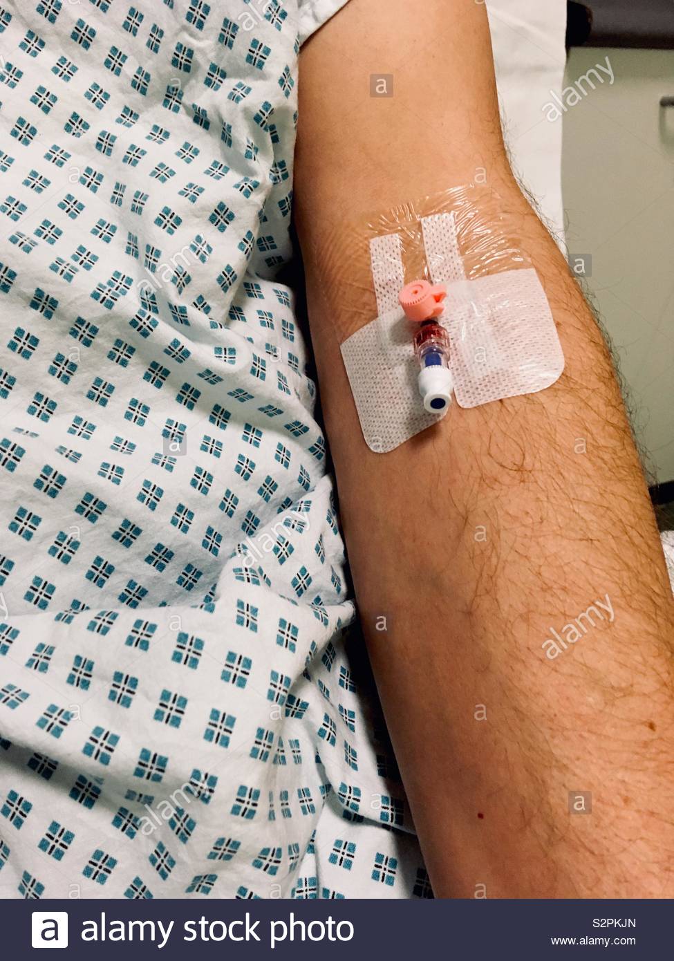 Cannulation Stock Photos & Cannulation Stock Images - Alamy