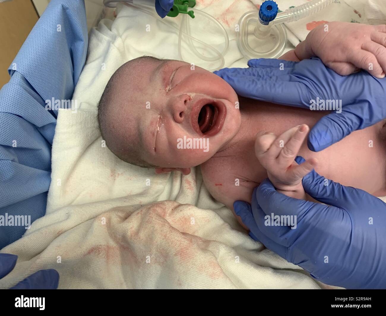 Born baby hospital hi-res stock photography and images - Alamy
