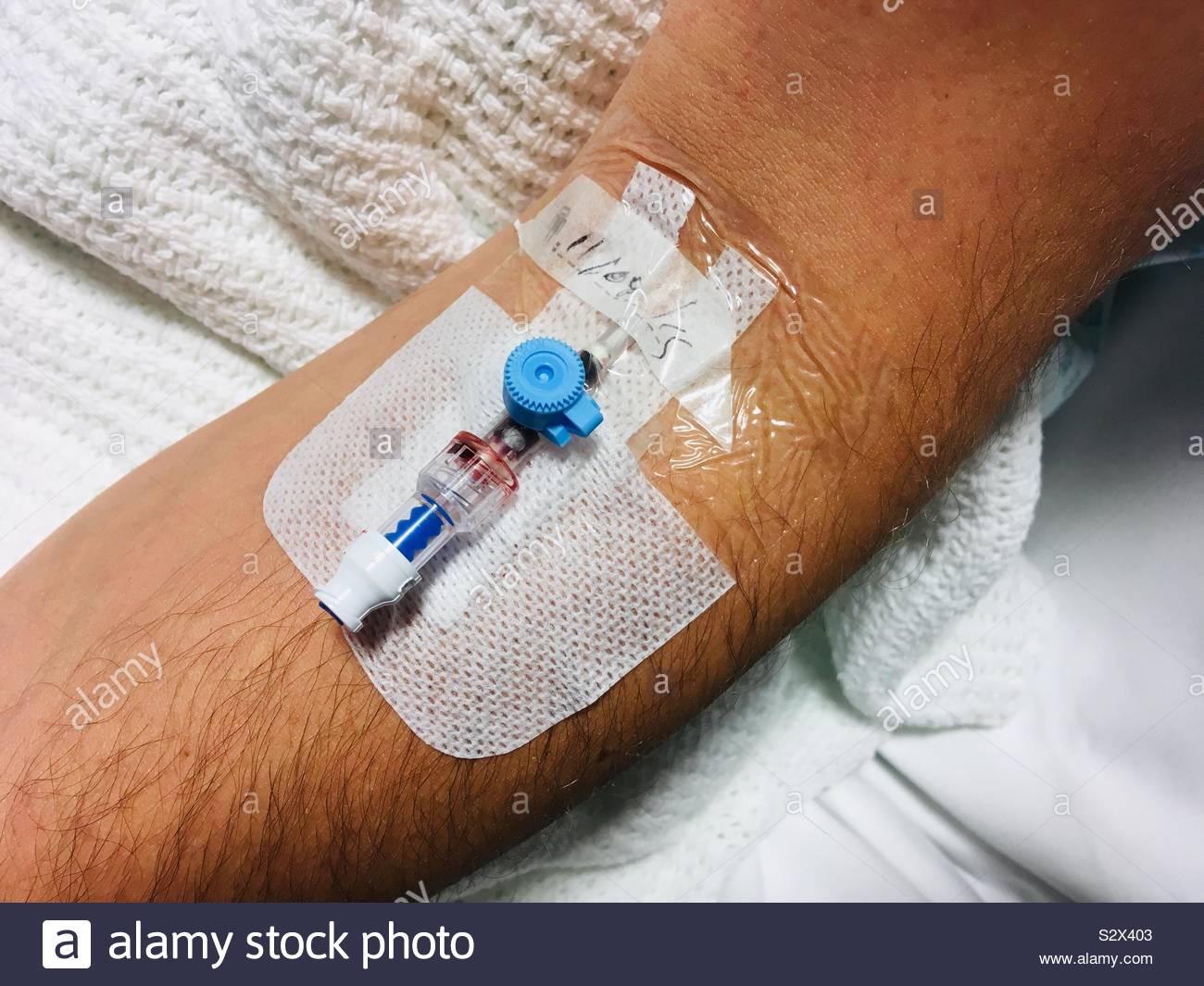 Cannula Arm High Resolution Stock Photography and Images - Alamy