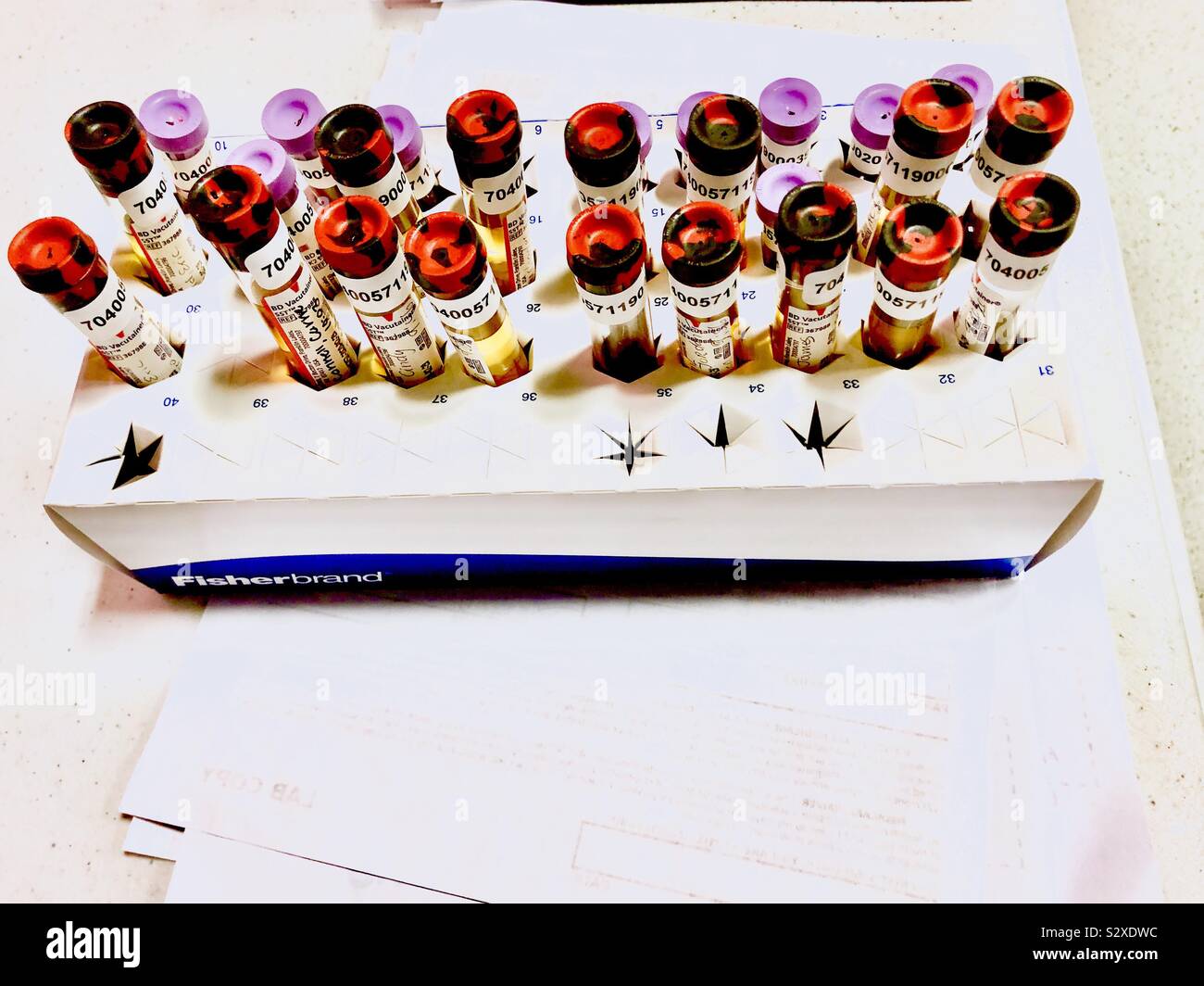Blood samples in lab rack Stock Photo - Alamy